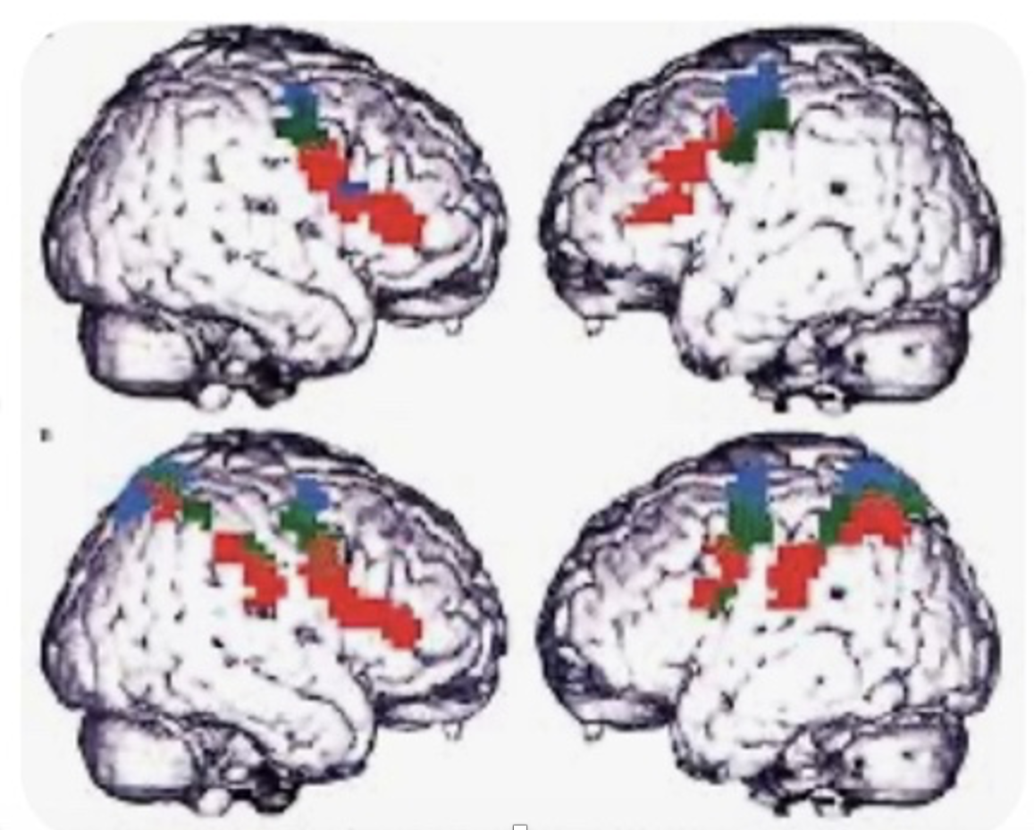 Time to talk trauma | Resolution